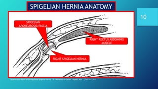 Laparoscopic Repair of Strangulated Spigelian Hernia | PPT