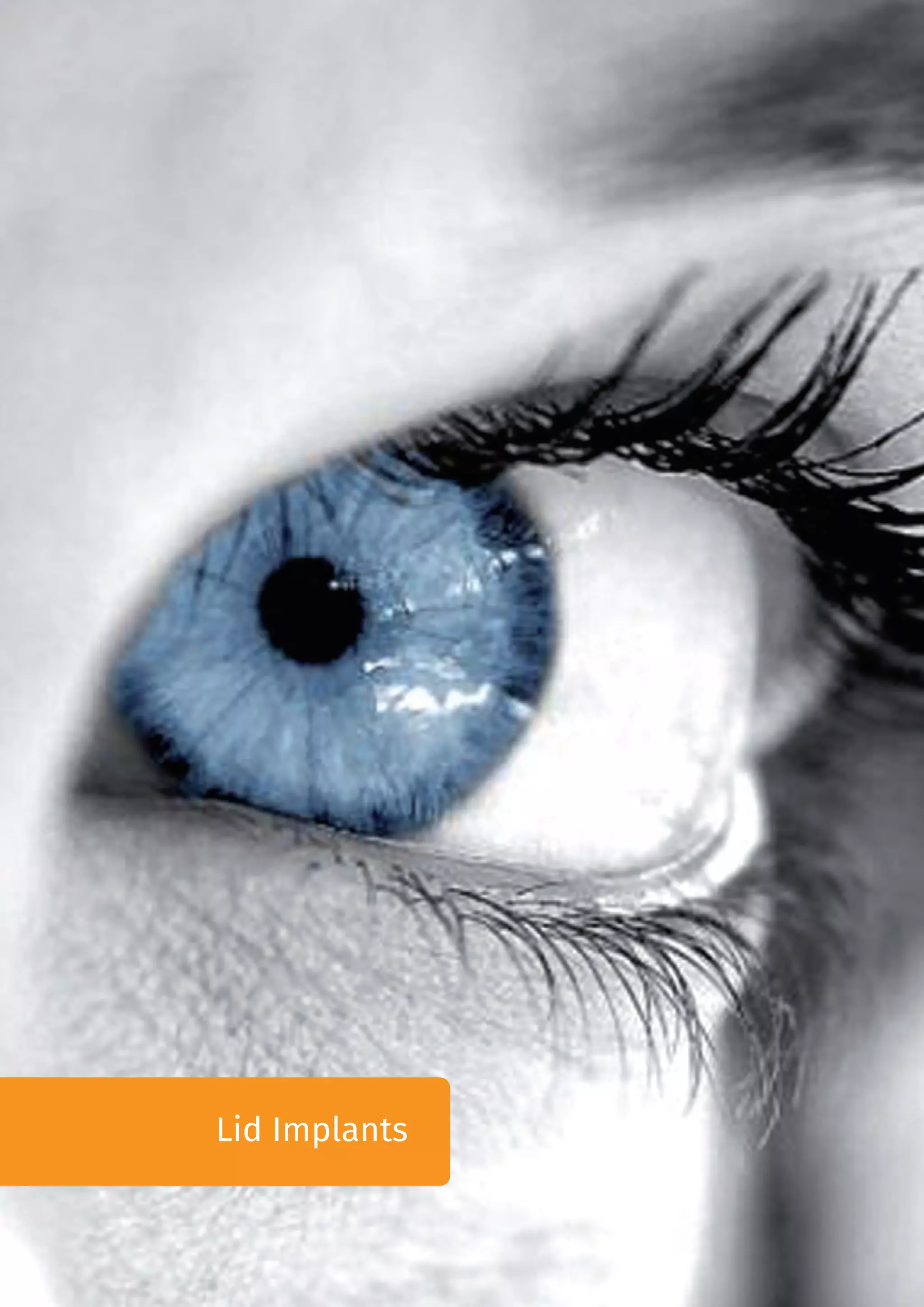 Spiggle & Theis brochure | PDF