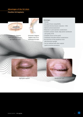 Spiggle & Theis brochure | PDF