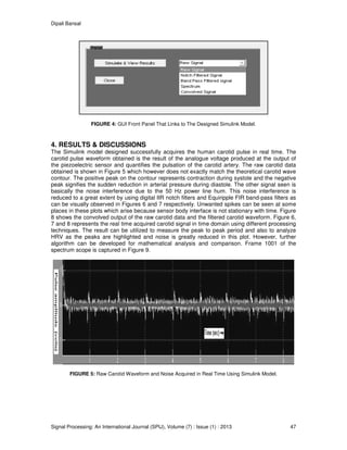 Computer Based Model to Filter Real Time Acquired Human Carotid Pulse | PDF