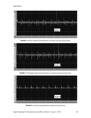 Computer Based Model to Filter Real Time Acquired Human Carotid Pulse | PDF