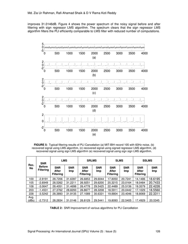 Noise Cancellation In Ecg Signals Using Computationally Pdf Digital Audio Computer