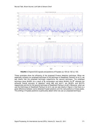 New Method of R-Wave Detection by Continuous Wavelet Transform | PDF | Heart and Cardiovascular ...