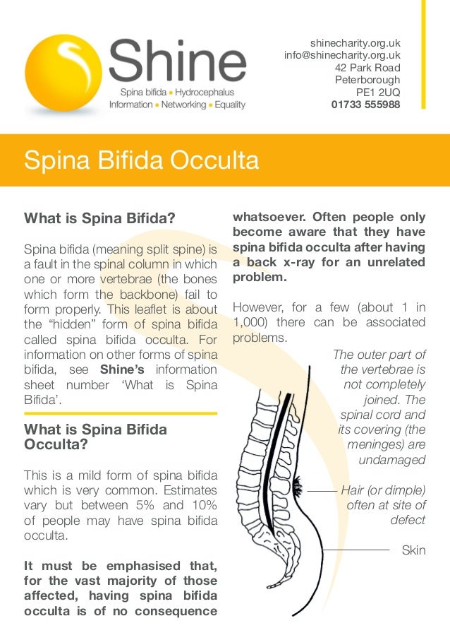 Spina bifida occulta