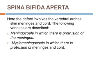 Spina Bifida -1.pptx