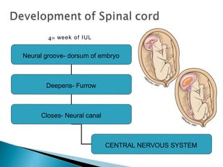 Spinabifida 130423125643-phpapp02 | PPT