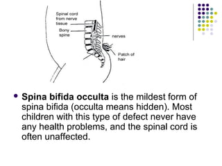 Spina Bifida Hair Patch