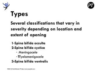 Spina Bifida - Dr Rohit Bhaskar | PDF