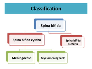 Spina bifida | PPTX