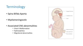Spina Bifida.pptx | Pregnancy | Reproductive Health