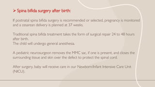 Spina Bifida | PDF