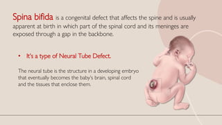 Spina Bifida | PDF