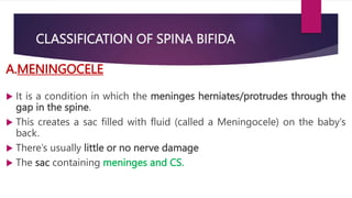 spina bifida (neural tube defects) .pptx