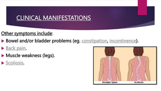 spina bifida (neural tube defects) .pptx