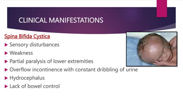 spina bifida (neural tube defects) .pptx