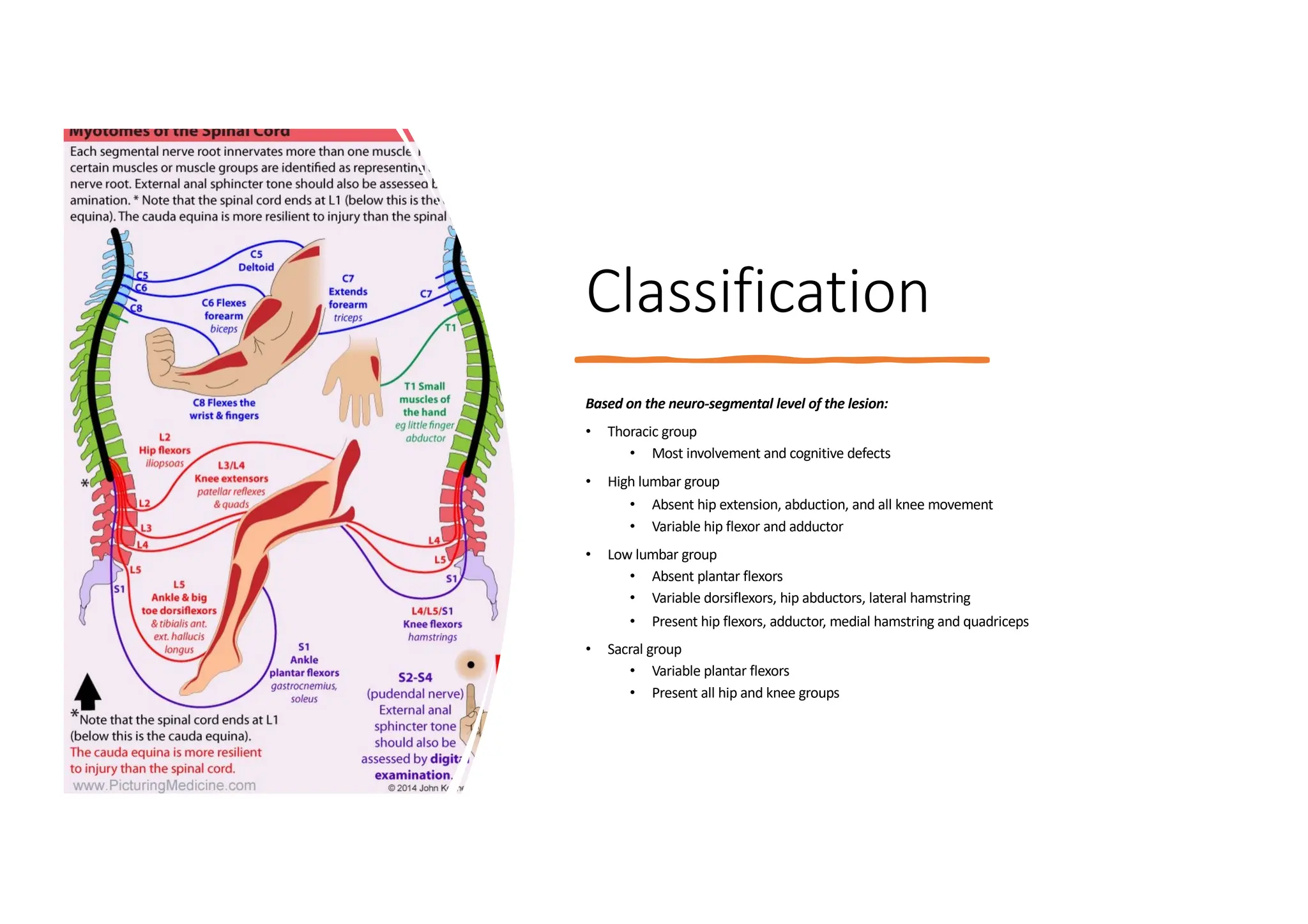 Spina Bifida physiotherapy for pediatrics.pdf
