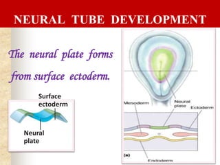 spina bifida in newborn disorders of high risk in pregnancy | PPT