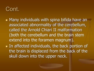 Spina Bifida Birth defect spinal nerves spinal cord | PPTX