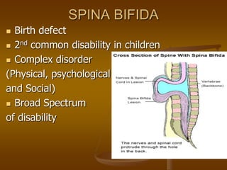 Spina Bifida Birth defect spinal nerves spinal cord | PPTX