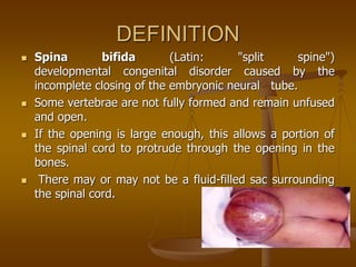 Spina Bifida Birth defect spinal nerves spinal cord | PPTX