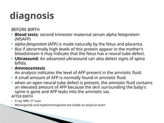 SPINA BIFIDA.pptx one of the neural tube defects | PPT