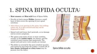 spina bifida-@medicosguide.youtube.pptx