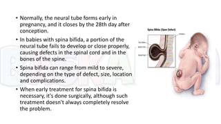 Spina Bifida (2).pptx2222222222222222222 | PPTX