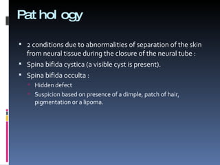 Spina bifida and epidural anaesthesia | PPT