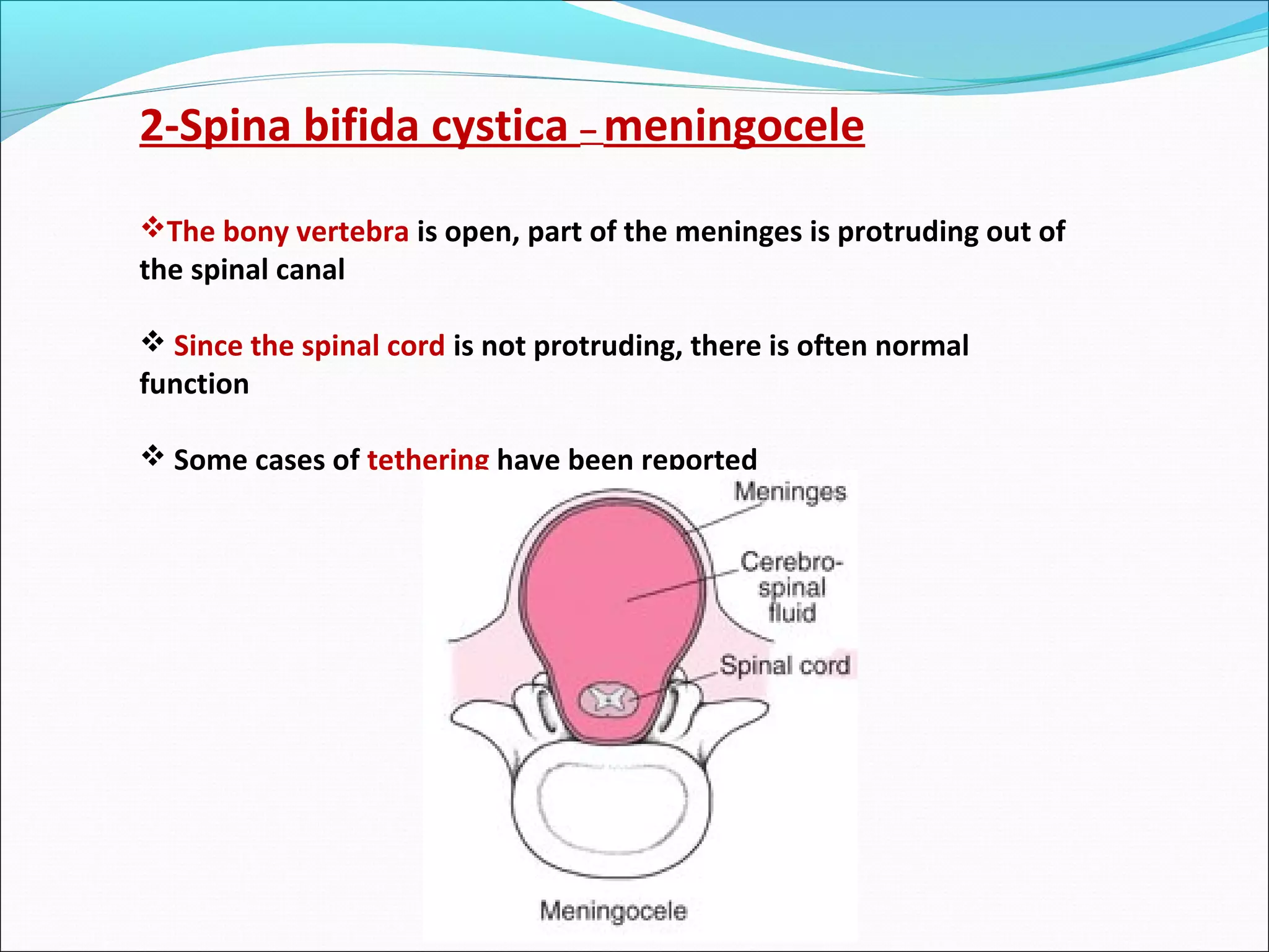 Spina bifida and physiotherapy | PPT