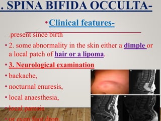 spina bifida and pt mangement [Autosaved].pptx
