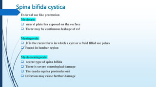 SPINA BIFIDA n-1.pptx Presentation on Spina bifida | PPTX