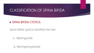 Spina bifida ppt | PPTX
