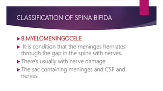 Spina bifida ppt | PPTX