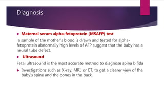 Spina bifida ppt | PPTX