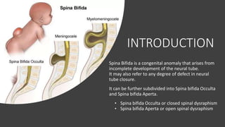 spina bifida presentation | PPTX | Pregnancy | Reproductive Health