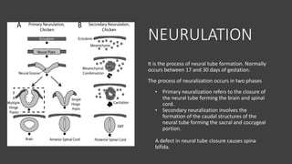 spina bifida presentation | PPTX