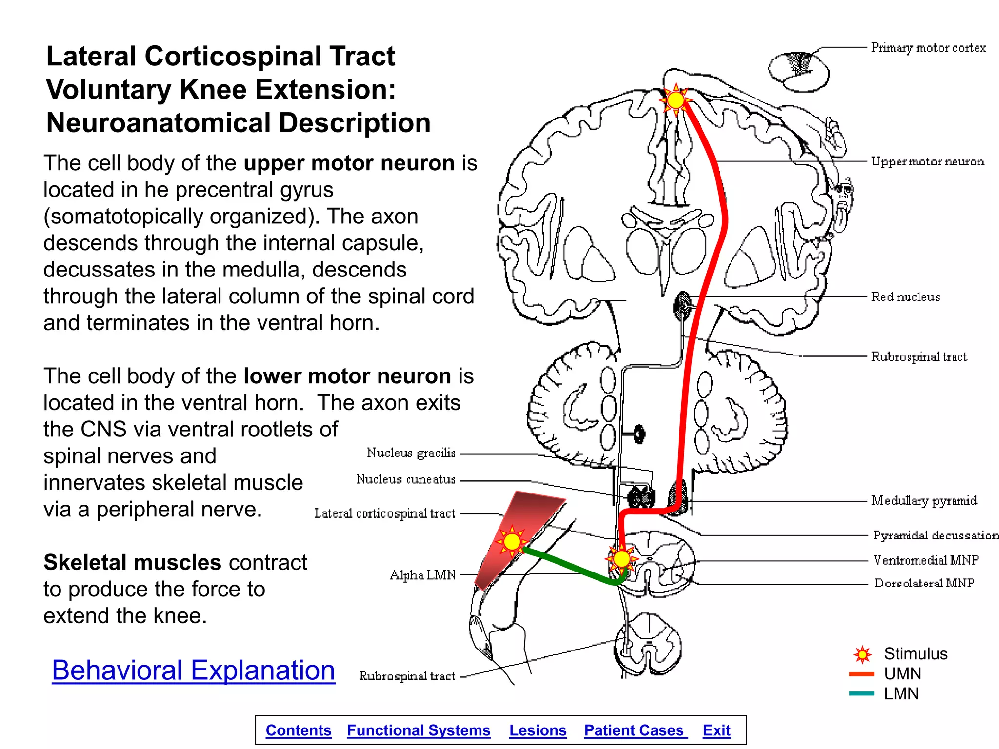 spinal-cord-injury-lesions.ppsx