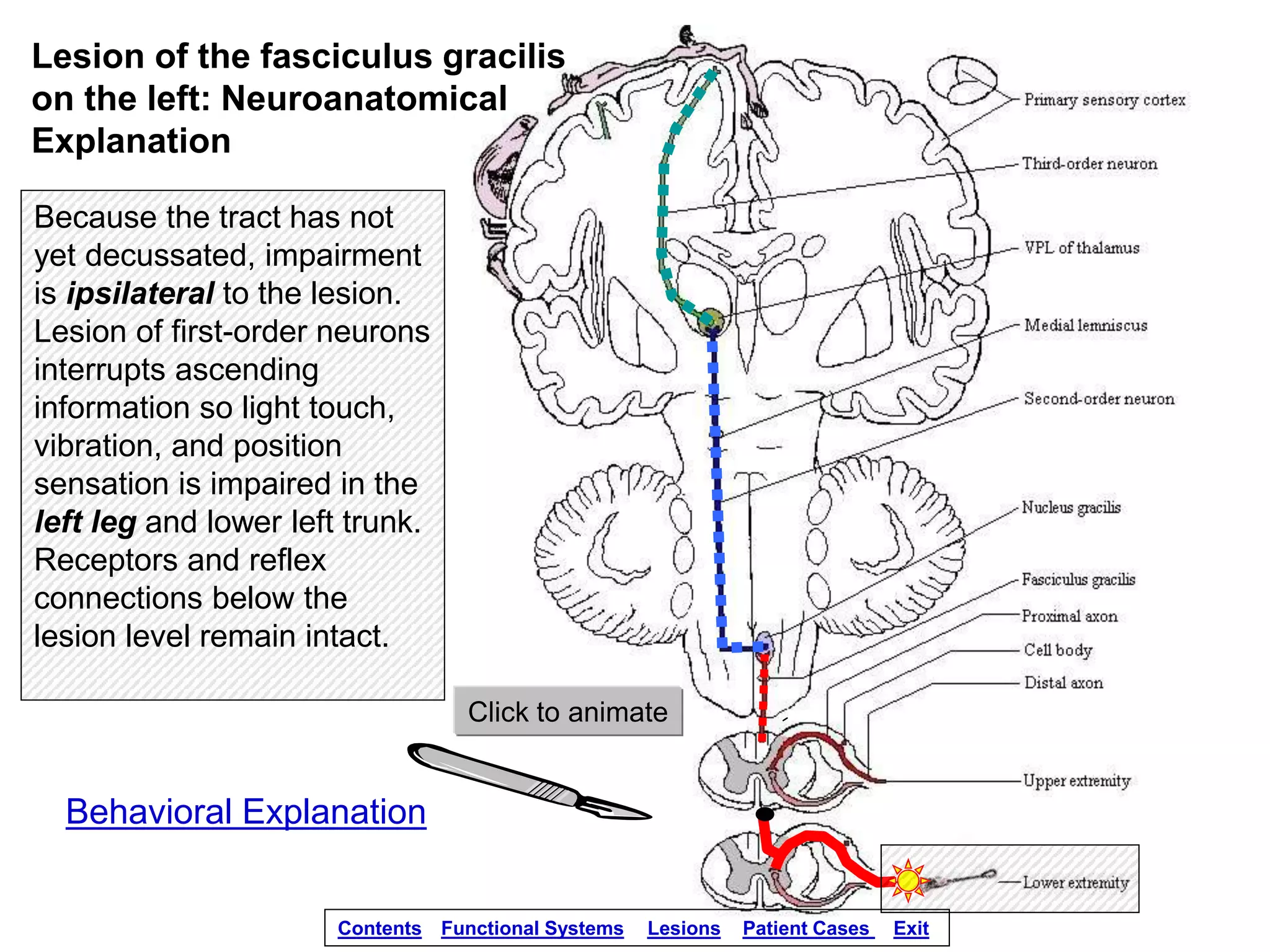 spinal-cord-injury-lesions.ppsx
