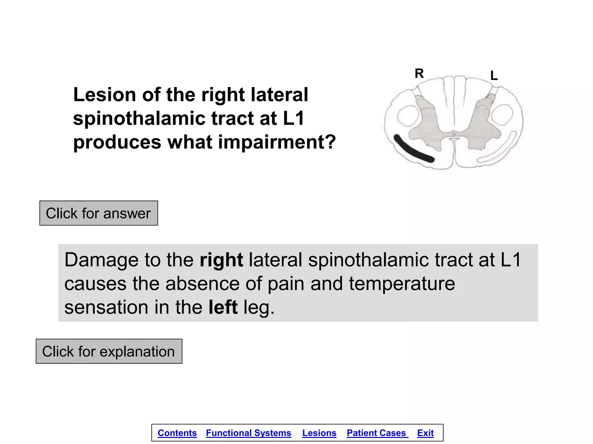 spinal-cord-injury-lesions.ppsx