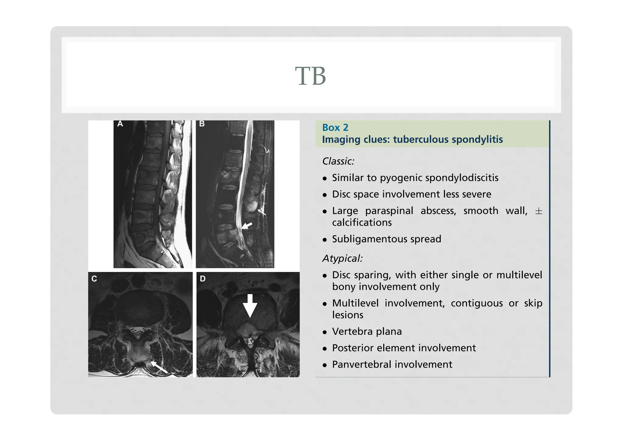 Spinal-Infections.pdf.................... | PDF | Bone and Joint ...