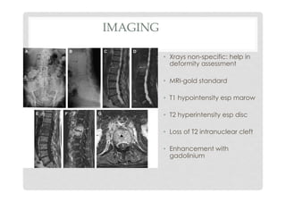 Spinal-Infections.pdf.................... | PDF | Bone and Joint ...