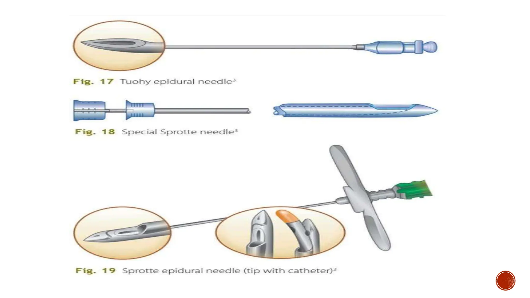 Epidural and spinal anesthesia are types of regional anesthesia that ...