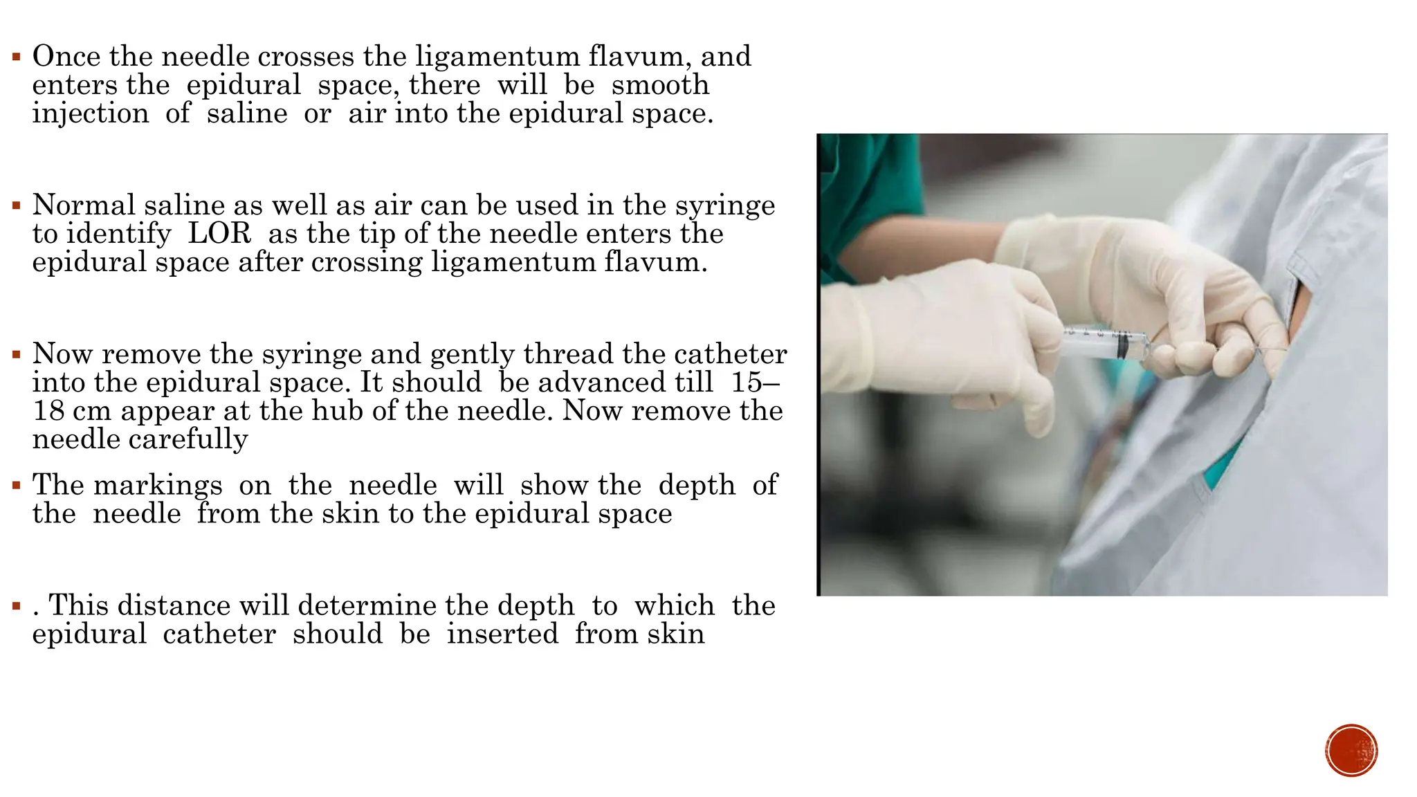 Epidural and spinal anesthesia are types of regional anesthesia that ...