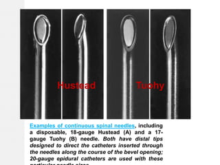 Spinal_Anaesthesia.ppt