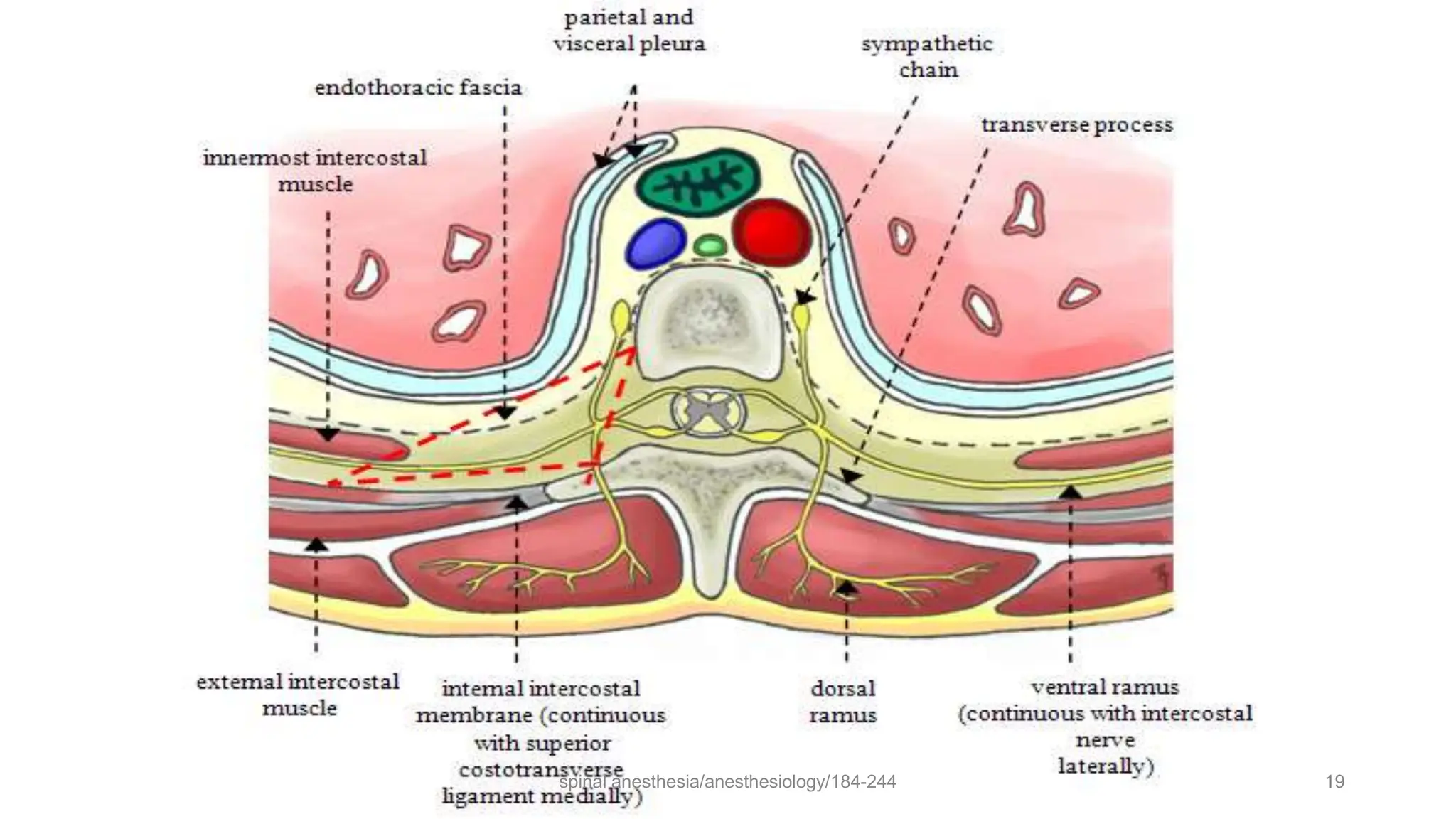 SPINAL ANAESTHESIA Anaesthesiology .pptx