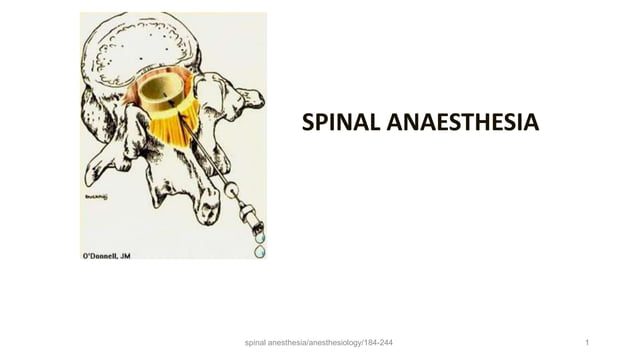 SPINAL ANAESTHESIA Anaesthesiology .pptx