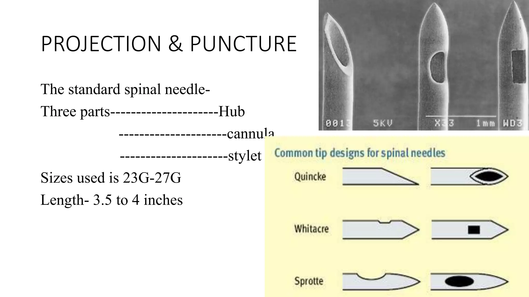 Spinal anaesthesia basics | PPTX | Brain and Nervous System Disorders ...