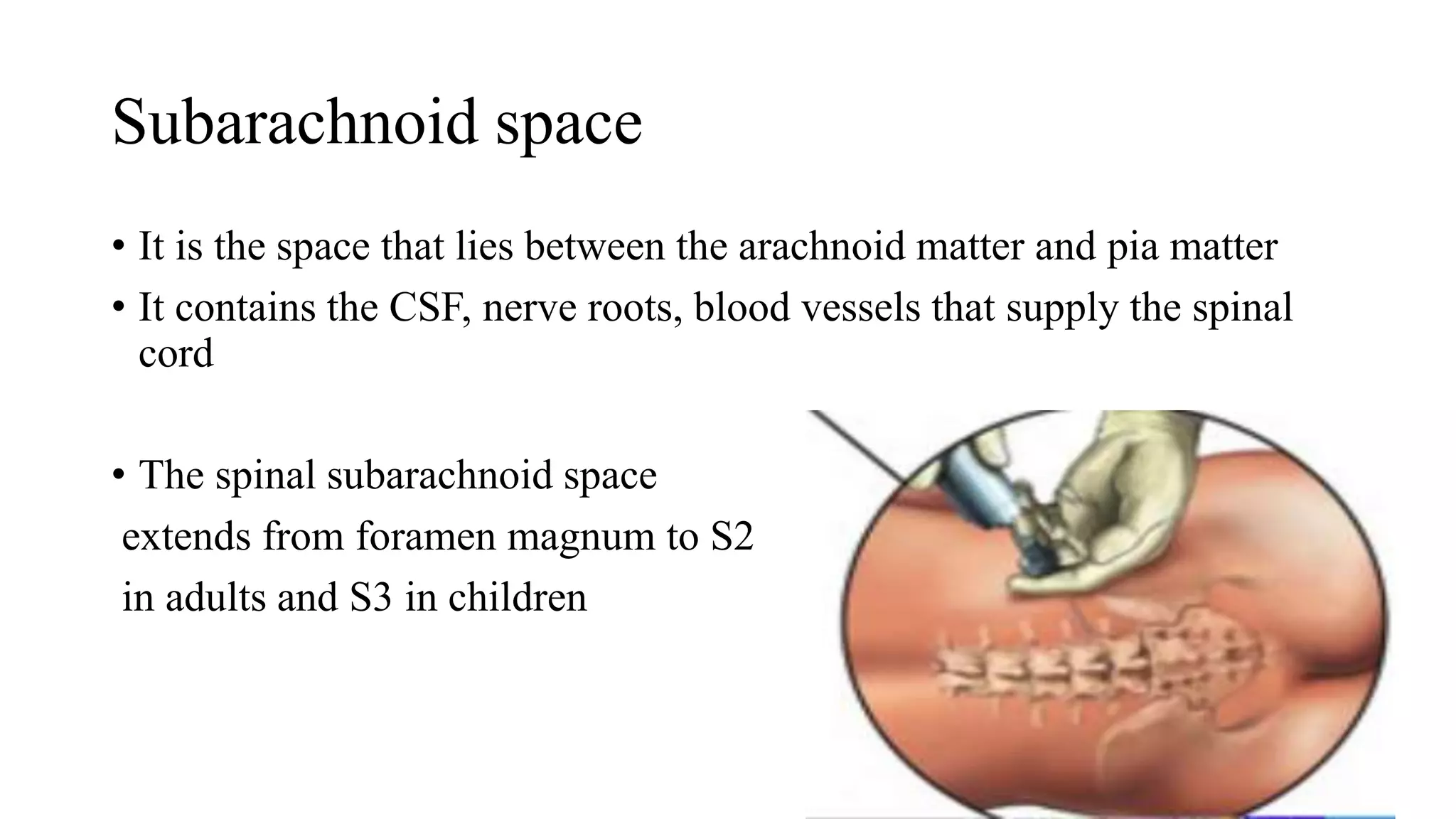 Spinal anaesthesia basics | PPTX