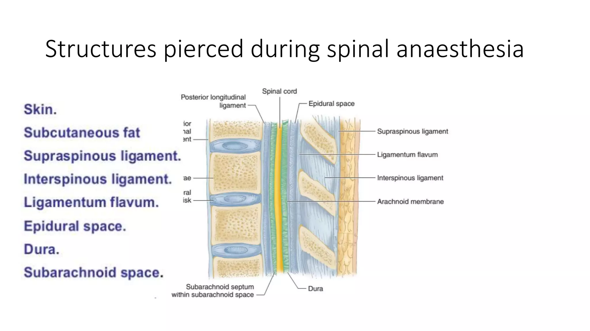 Spinal anaesthesia basics | PPTX