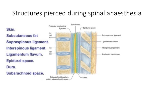 Spinal anaesthesia basics